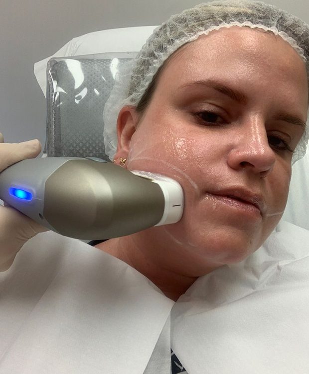 O que é Ultraformer e para que serve? 2025